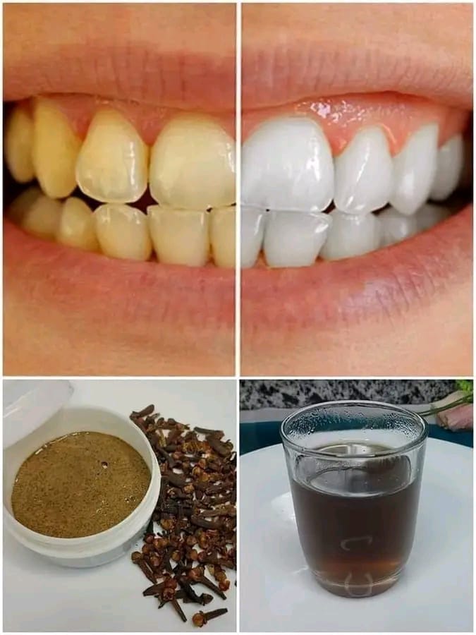 🤩 Sette Metodi per un Sorriso Smagliante: La Guida Definitiva allo ...